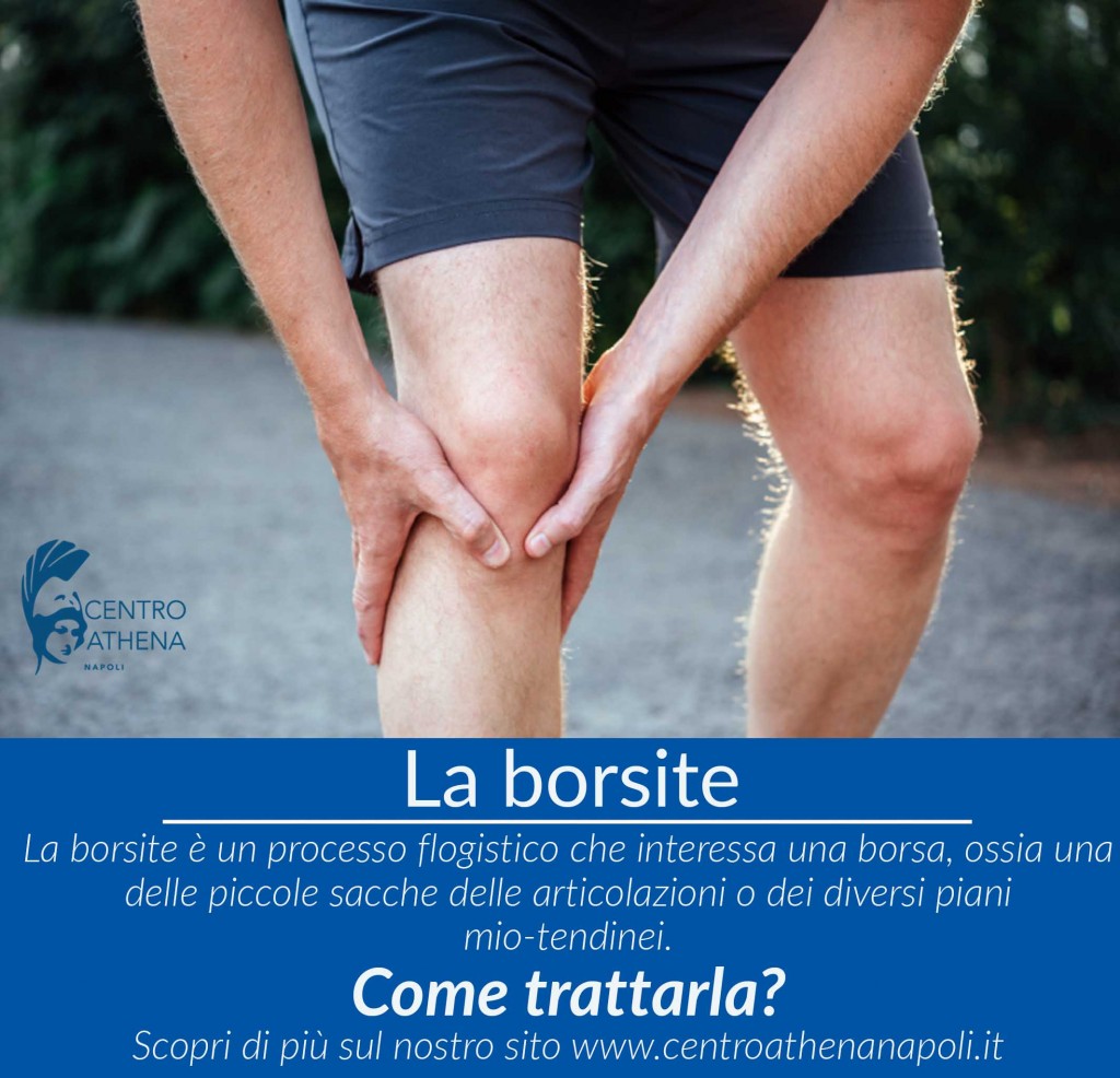 La Borsite | Centro Athena Napoli